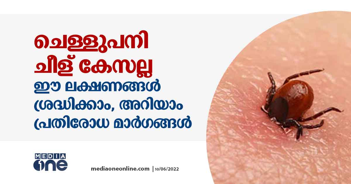 ചെള്ളുപനി ചീള് കേസല്ല; ഈ ലക്ഷണങ്ങൾ ശ്രദ്ധിക്കാം, അറിയാം പ്രതിരോധ മാർഗങ്ങൾ