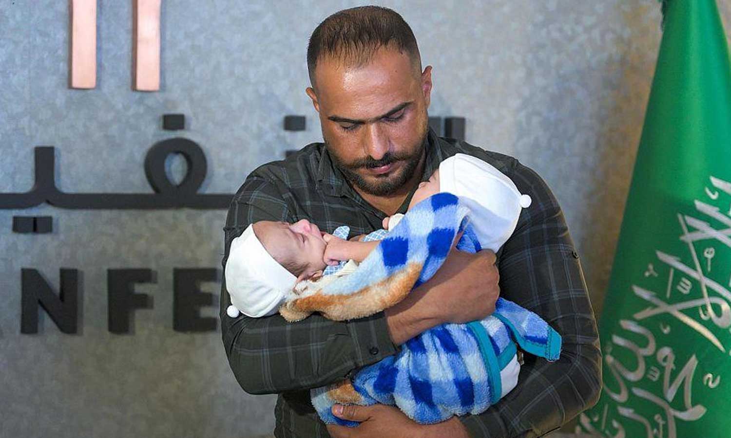 Iraqi Siamese twins come to Saudi Arabia for surgery – Archyde