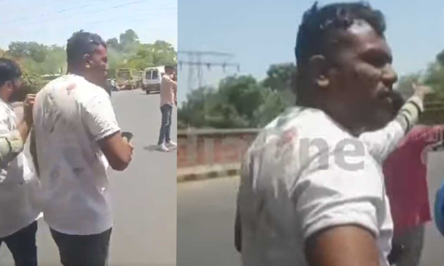 അഹമ്മദാബാദ് വിമാനാപകടത്തിൽ രക്ഷപ്പെട്ട വിശ്വാസ് കുമാർ നടന്നുപോകുന്ന ...